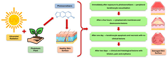 New Insights Concerning Phytophotodermatitis Induced by Phototoxic Plants