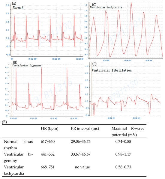 Barium Chloride-Induced Cardiac Arrhythmia Mouse Model Exerts an ...