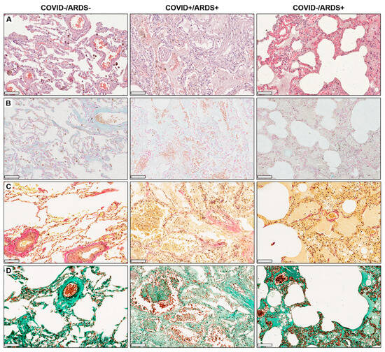 A Histological Analysis and Detection of Complement Regulatory Protein ...