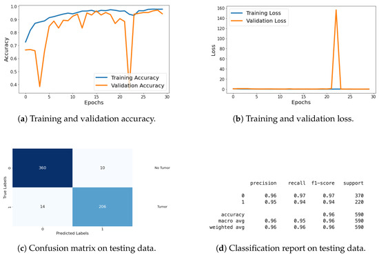 A Unified Pipeline for Simultaneous Brain Tumor Classification and Segmentation Using Fine-Tuned ...