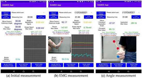 The Development of a System for Elbow Joint Range of Motion Measurement ...