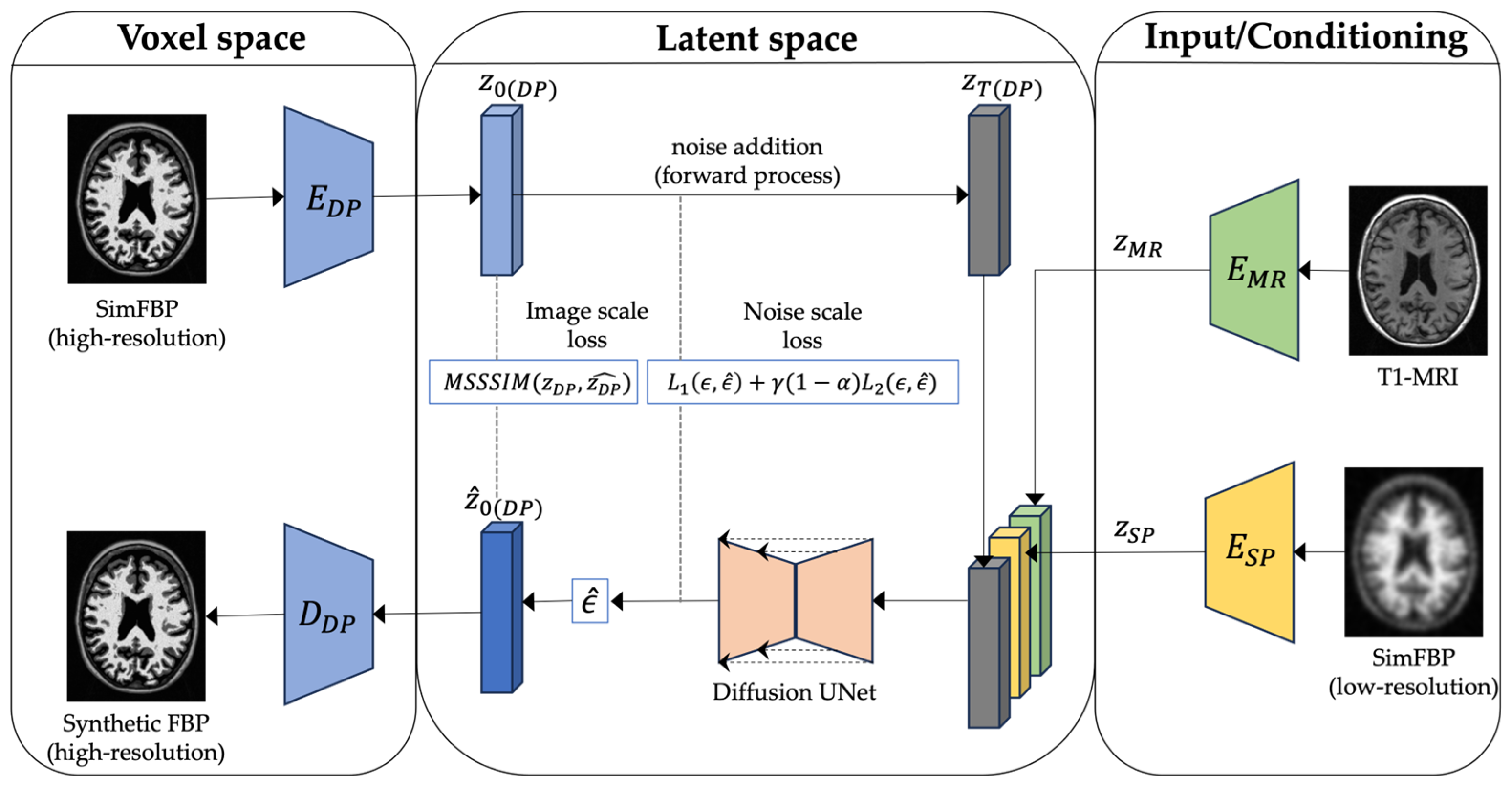 Enhancing Amyloid PET Quantification: MRI-Guided Super-Resolution Using ...