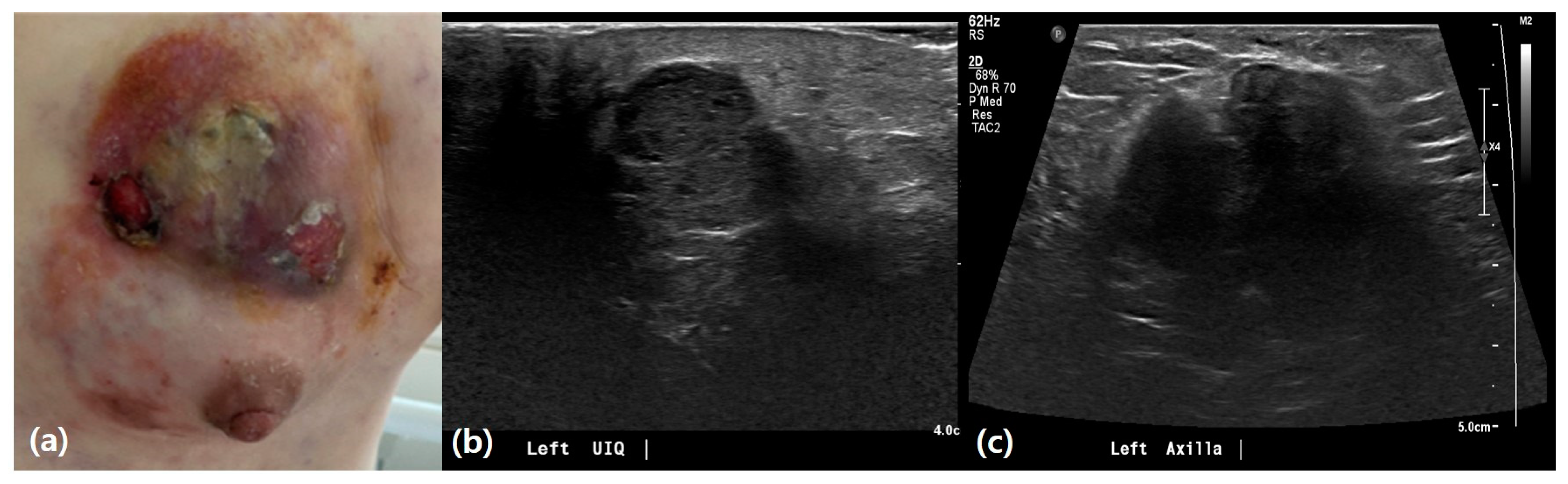 Analysis of Clinically Symptomatic Patients to Differentiate ...