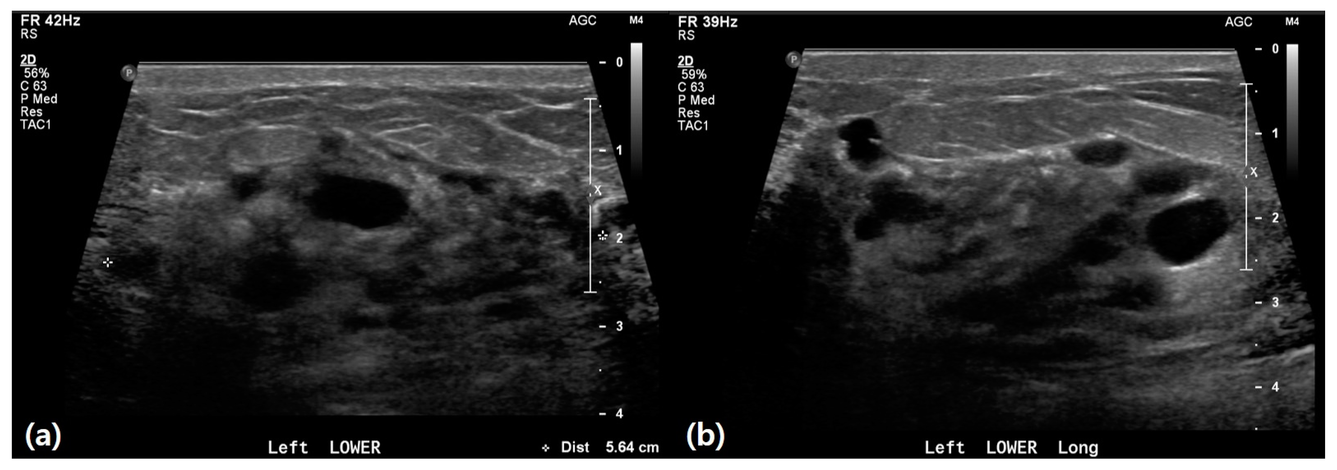 Analysis of Clinically Symptomatic Patients to Differentiate ...