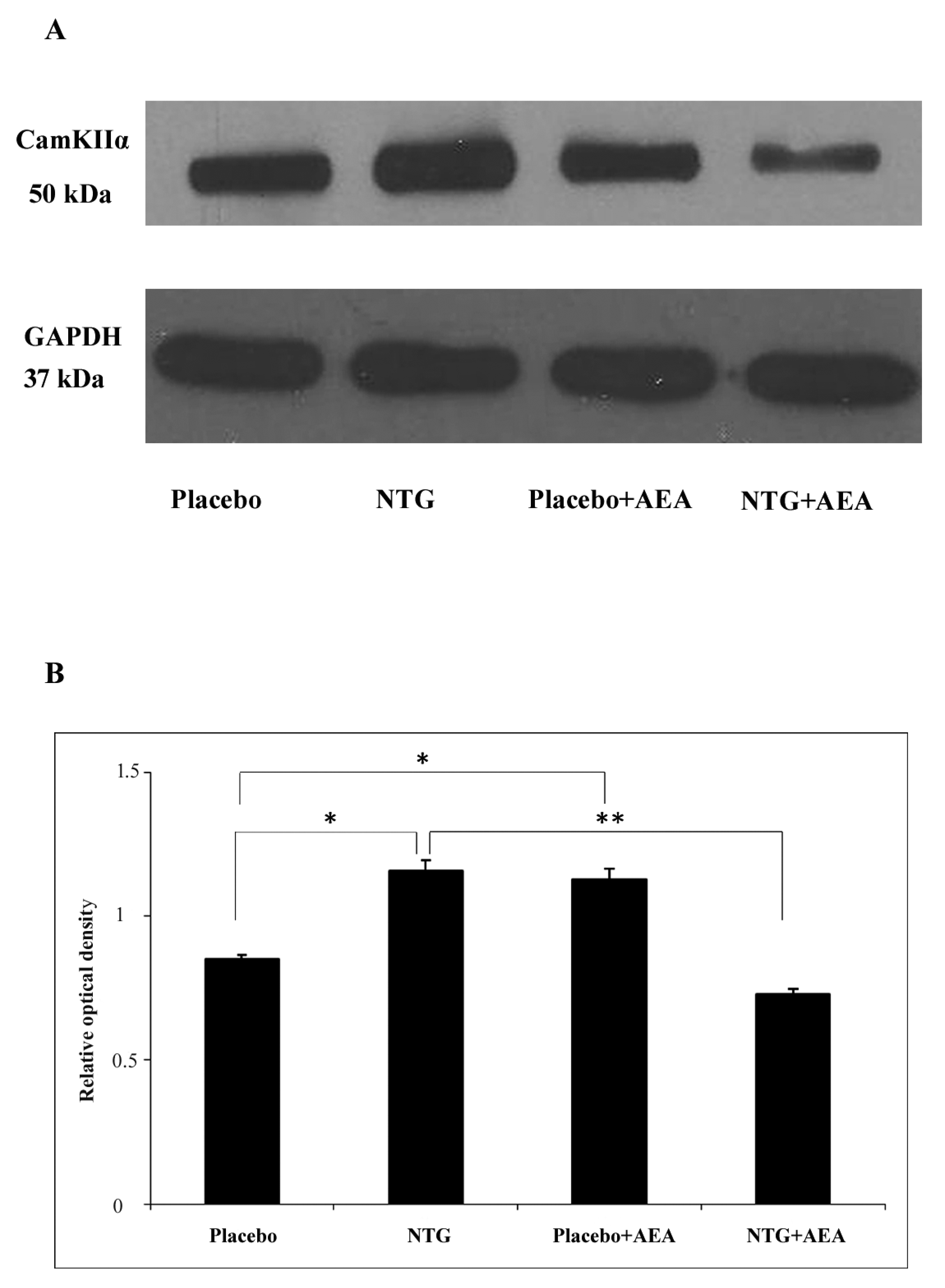 CamKIIα and VPAC1 Expressions in the Caudal Trigeminal Nucleus of Rats ...