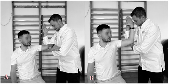 Understanding Scapulohumeral Periarthritis: A Comprehensive Systematic ...