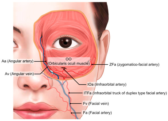 Anatomical-Based Filler Injection Diagnosis to Treatment Techniques ...