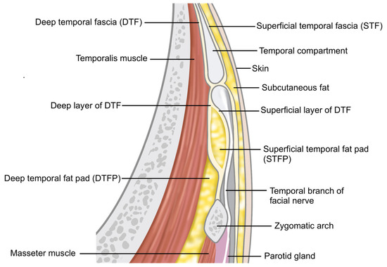 An Expert Guide to Anatomy-Based Filler Injection for the Temple ...