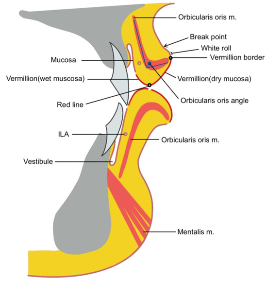 Anatomical-Based Diagnosis and Filler Injection Techniques: Lips and ...