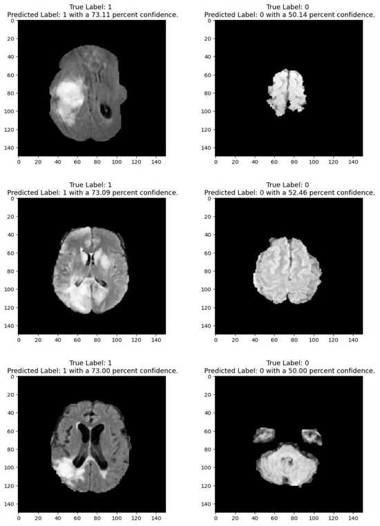 Brain Tumor Detection and Prediction in MRI Images Utilizing a Fine ...