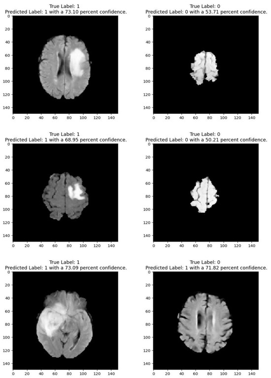 Brain Tumor Detection and Prediction in MRI Images Utilizing a Fine ...
