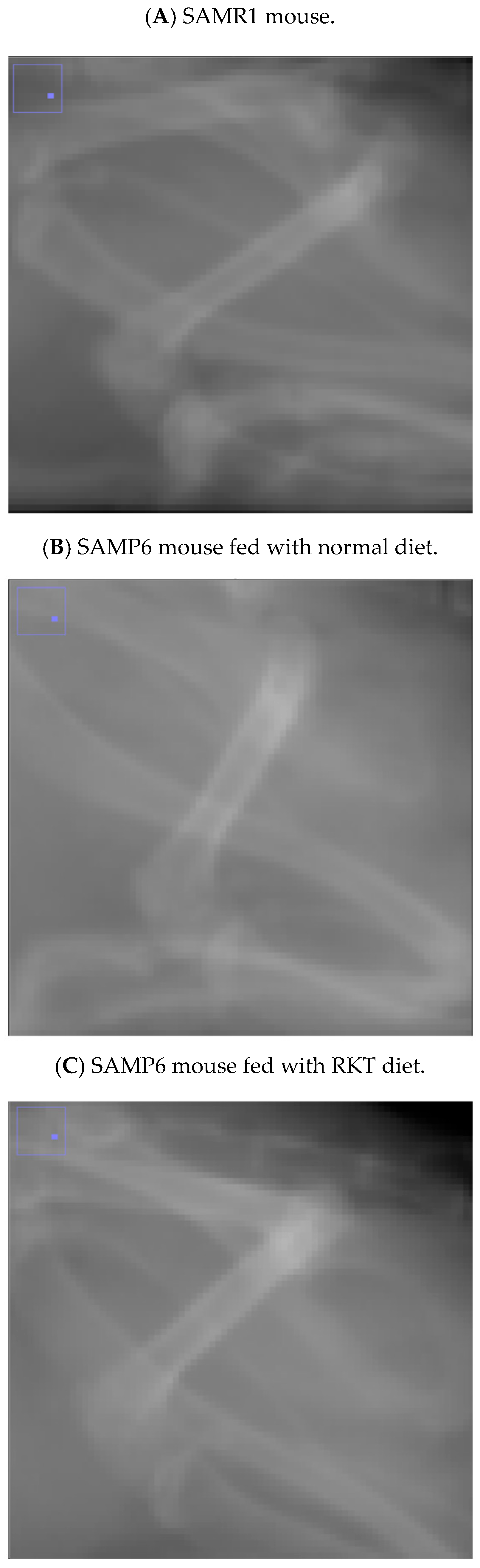 Prevention of Osteoporosis in SAMP6 Mice by Rikkunshi-To: Japanese ...