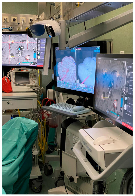 Simulators with Haptic Feedback in Neurosurgery: Are We Reaching the ...