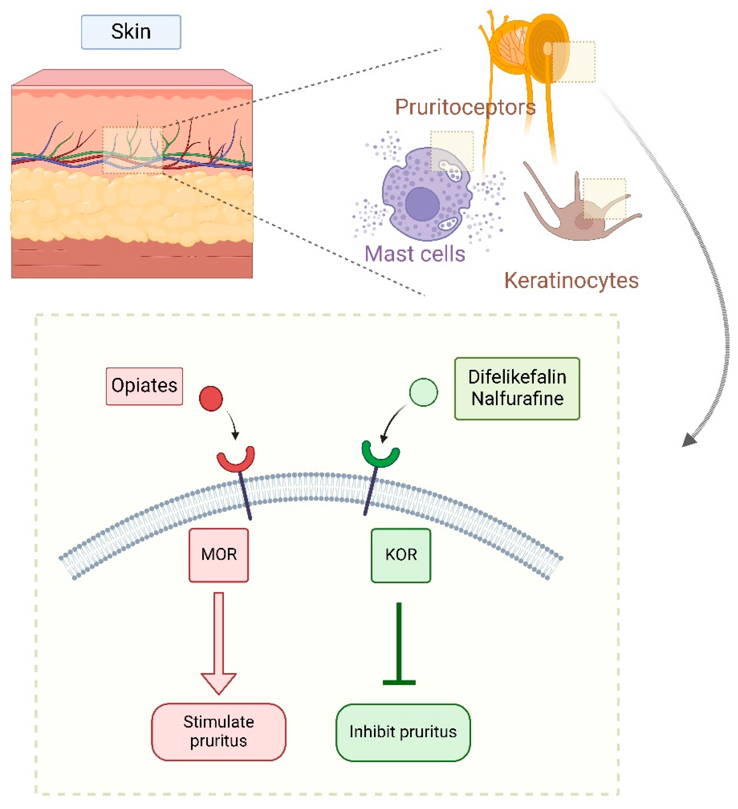 Pruritus in Uremic Patients: Approaches to Alleviating a Common Symptom ...