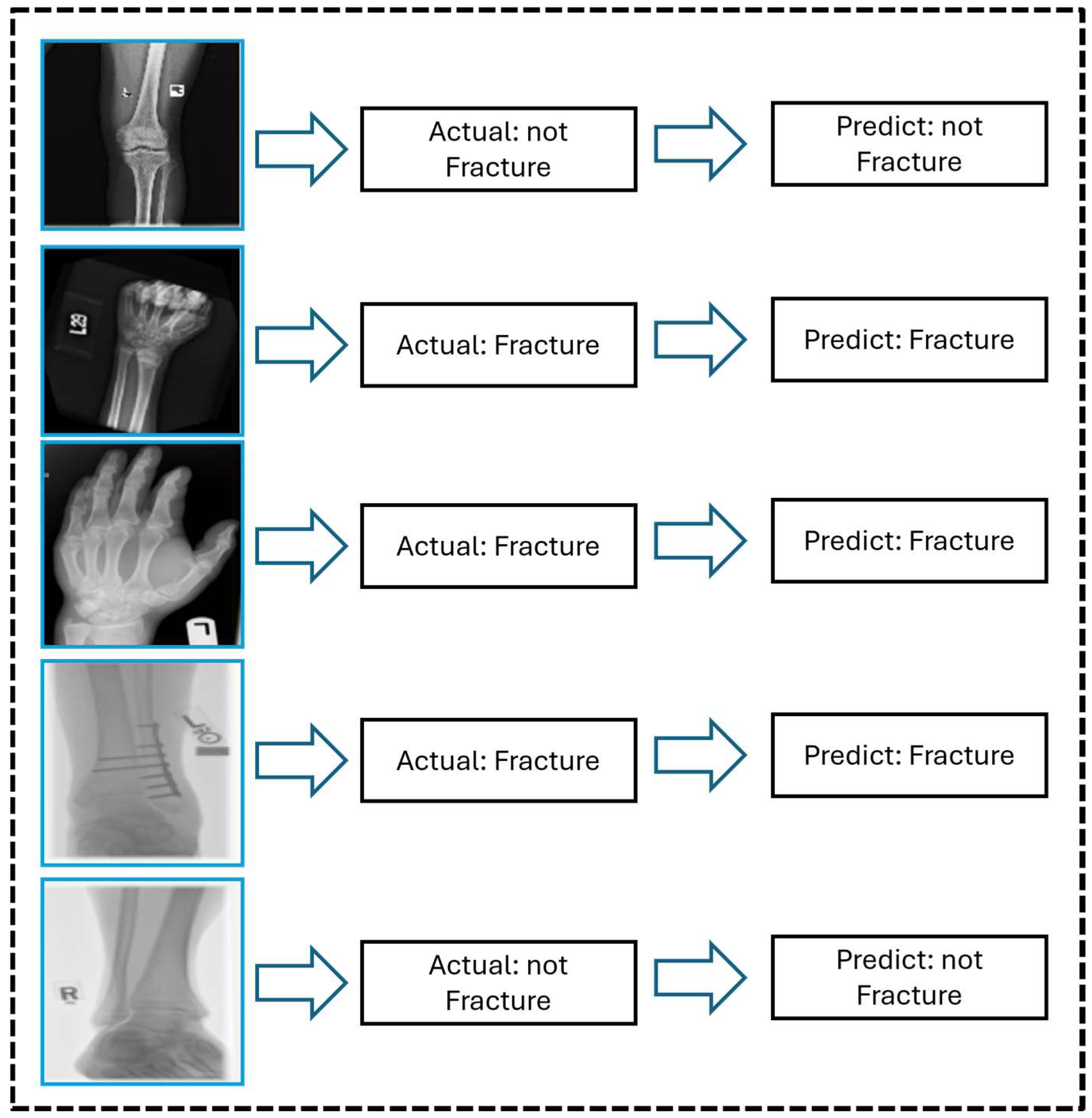 Automatic Fracture Detection Convolutional Neural Network with Multiple Attention Blocks Using ...