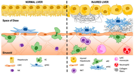 The Space of Disse: The Liver Hub in Health and Disease