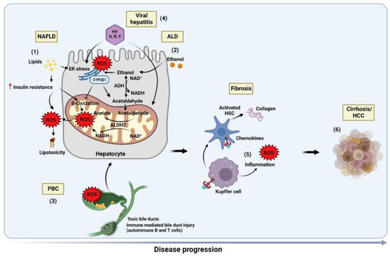Role of Oxidative Stress in Liver Disorders