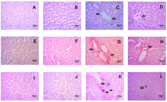 Tempol Alters Antioxidant Enzyme Function, Modulates Multiple Genes ...