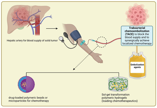 An Updated Review on Advances in Hydrogel-Based Nanoparticles for Liver ...