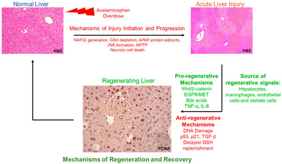 Regeneration and Recovery after Acetaminophen Hepatotoxicity
