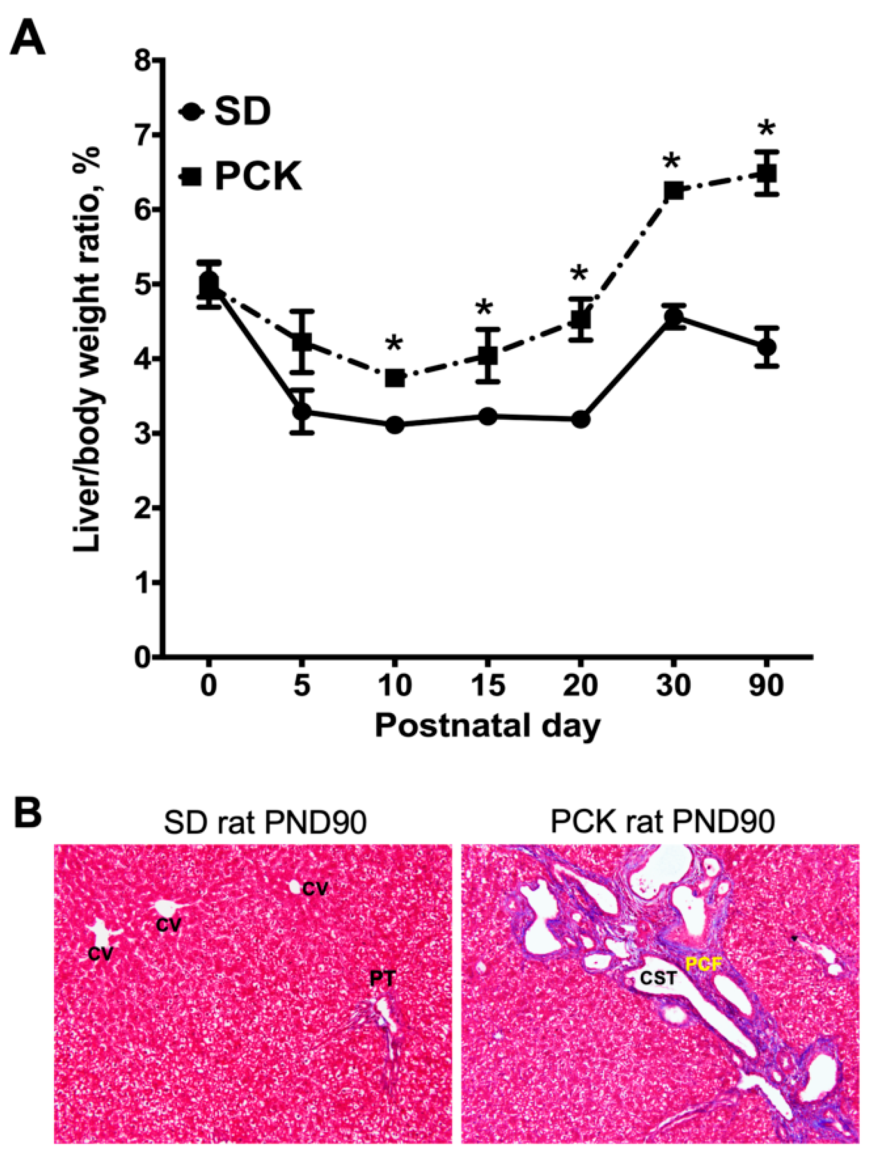 Transcriptomics of Congenital Hepatic Fibrosis in Autosomal Recessive ...