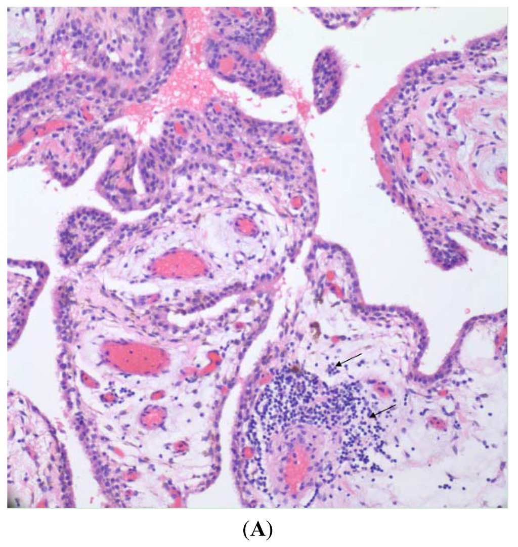 The Synovial Lining and Synovial Fluid Properties after Joint Arthroplasty