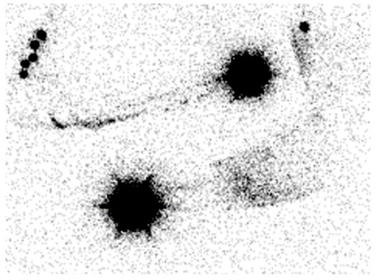 The Lymphatic System—A Surgeon’s Point of View