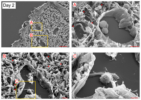 Scanning Electron Microscopy Analysis of Lymphatic Regeneration in a ...