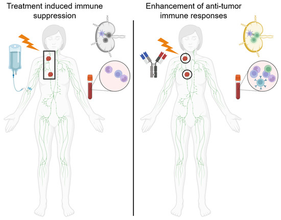 Lymphatics | Free Full-Text | Incorporating Immunotherapy with ...
