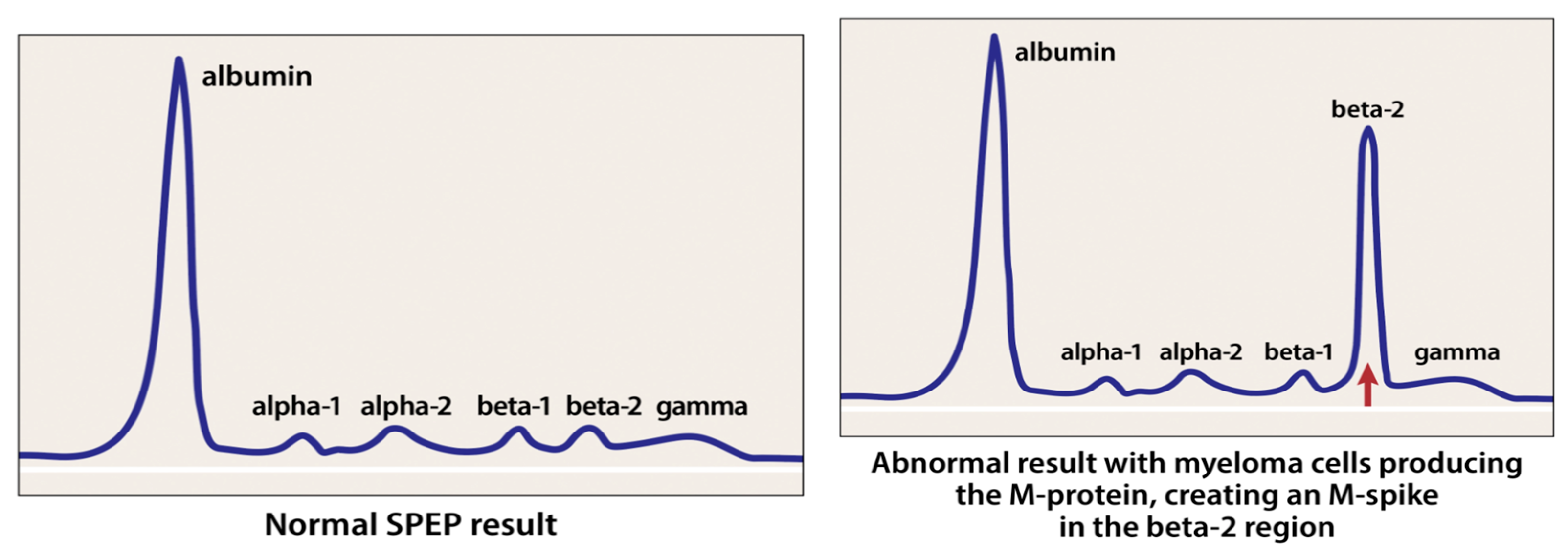 Advancements in Multiple Myeloma Therapies: A Comprehensive Review by ...