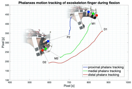Design of a 3D-Printed Hand Exoskeleton Based on Force-Myography ...