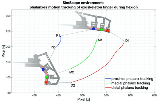 Design of a 3D-Printed Hand Exoskeleton Based on Force-Myography ...