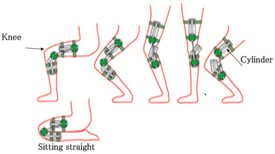 New Mechanical Knee Supporter Device for Shock Absorption