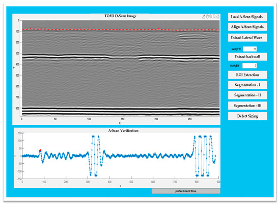 Zero-Defect Manufacturing and Automated Defect Detection Using Time of ...