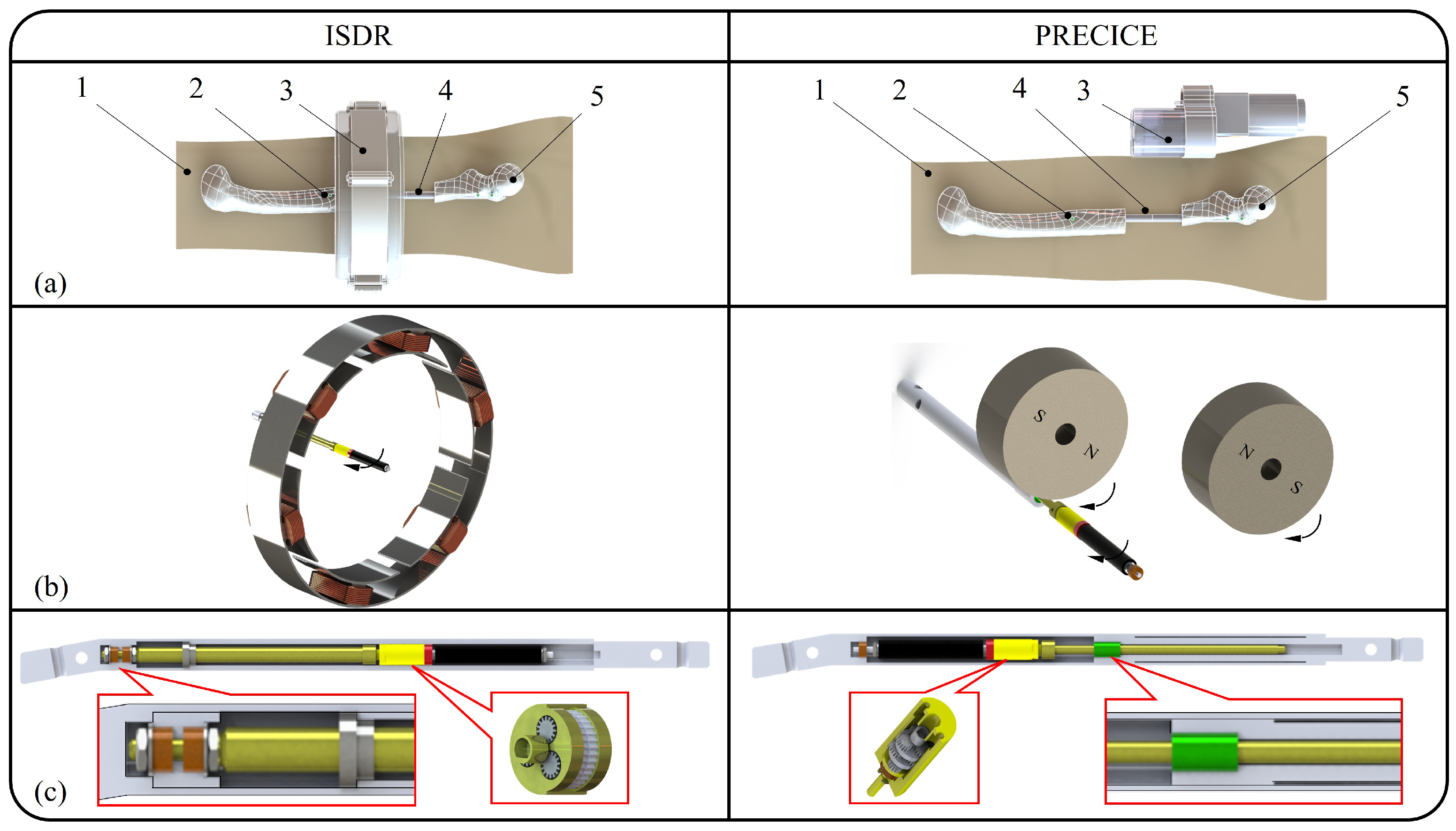 Intramedullary Skeletal Distraction Robot: Novel Design and ...