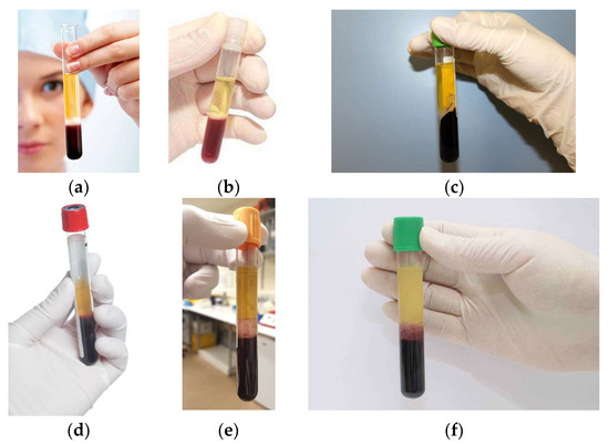 Robotic System for Blood Serum Aliquoting Based on a Neural Network ...