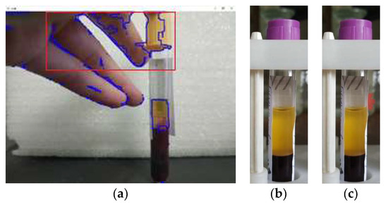 Robotic System for Blood Serum Aliquoting Based on a Neural Network ...