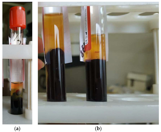 Robotic System for Blood Serum Aliquoting Based on a Neural Network ...
