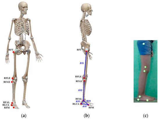 Determination of Anthropometric Lengths of Body Segments Using Machine ...