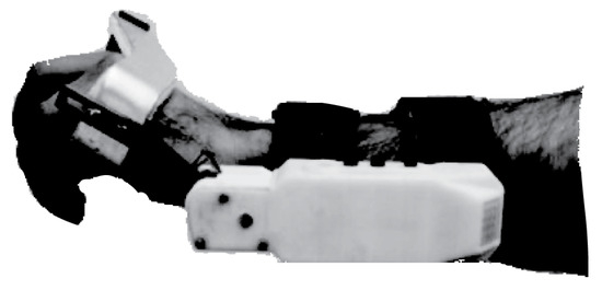 Machines | Free Full-Text | State of the Art in Wearable Wrist ...