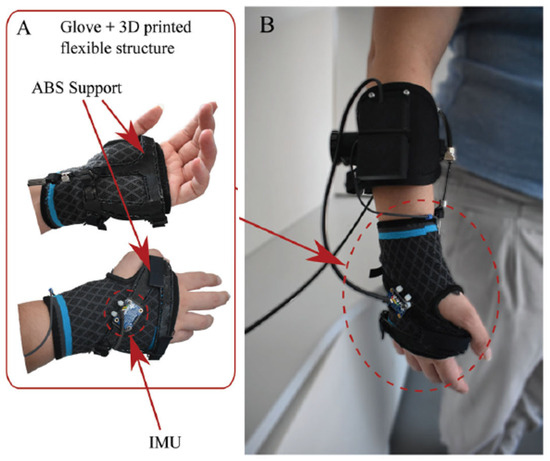 Machines | Free Full-Text | State of the Art in Wearable Wrist ...