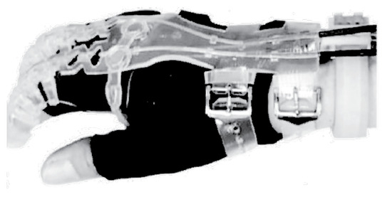 State of the Art in Wearable Wrist Exoskeletons Part II: A Review of ...