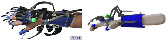 Machines | Free Full-Text | State of the Art in Wearable Wrist ...