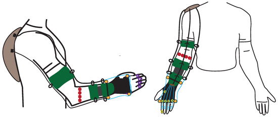 Machines | Free Full-Text | State of the Art in Wearable Wrist ...