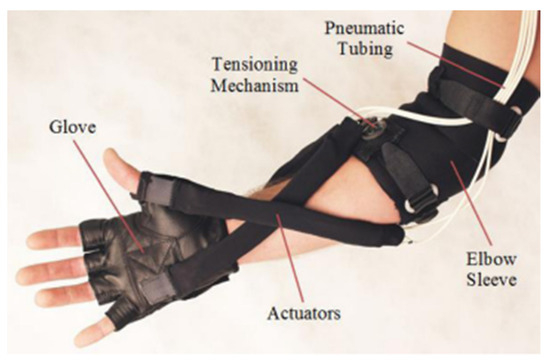 A Review of Wrist Rehabilitation Robots and Highlights Needed for New ...