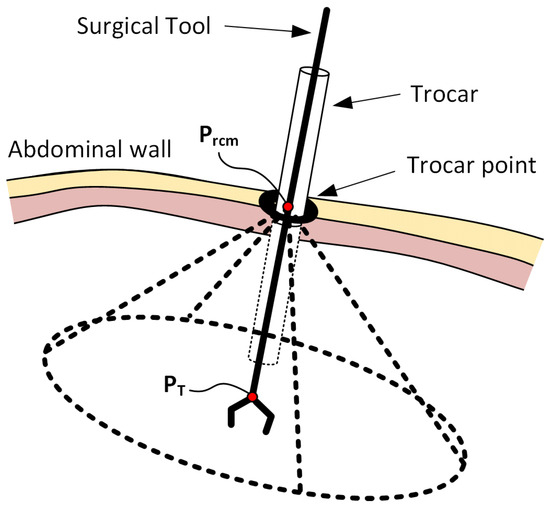 Modeling, Simulation and Control of the Double Delta Surgical Robot