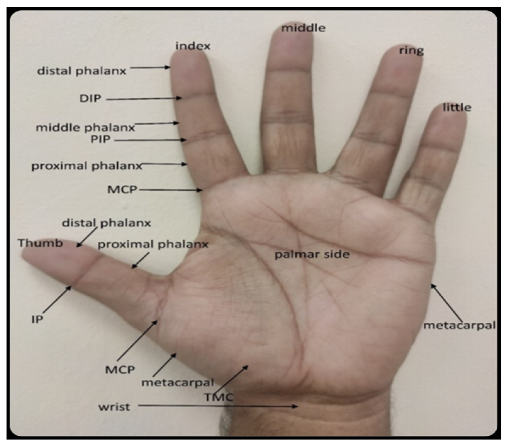 Optimal Design of a Bilateral Stand-Alone Robotic Motion-Assisted ...