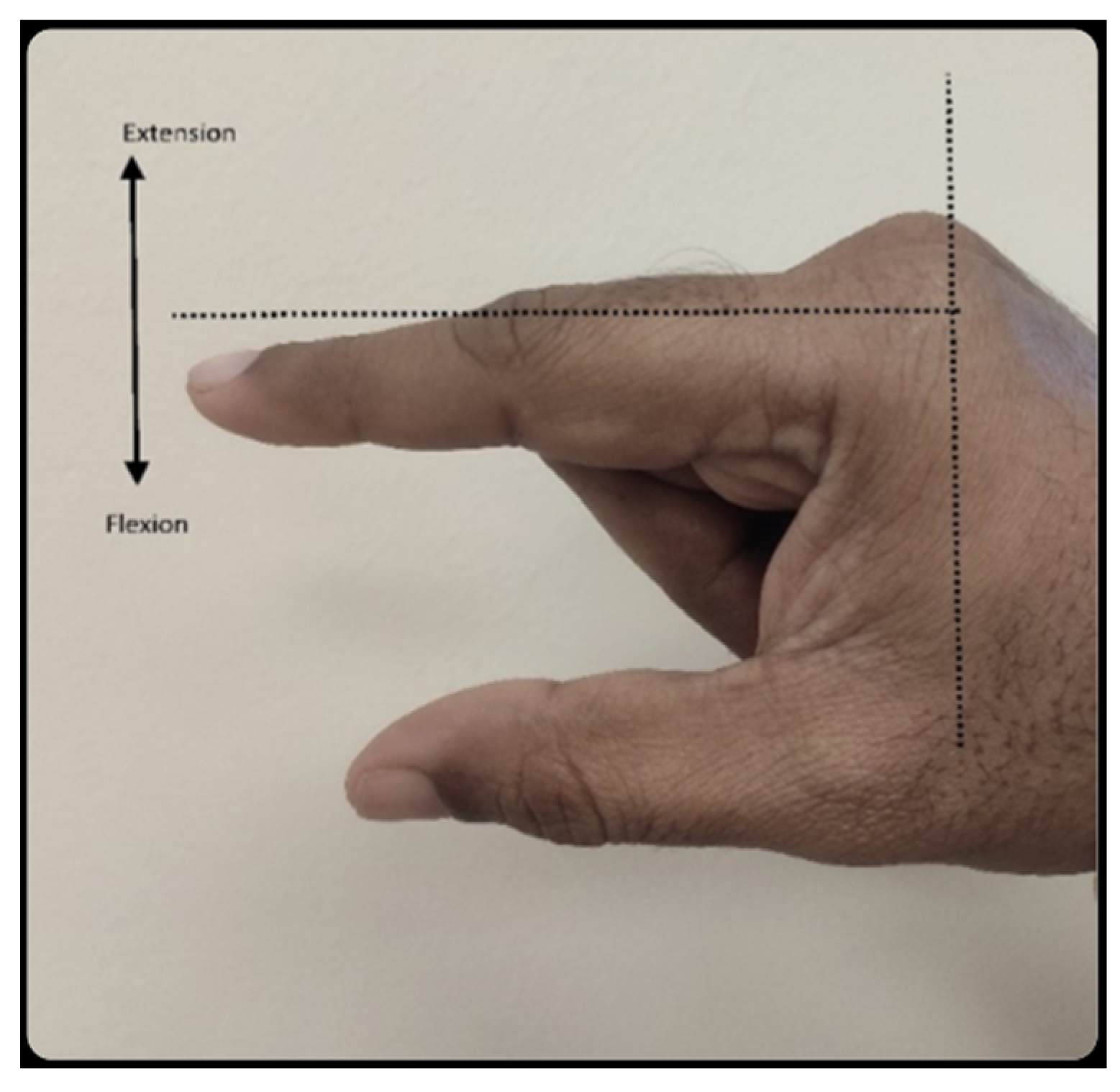 Optimal Design of a Bilateral Stand-Alone Robotic Motion-Assisted ...