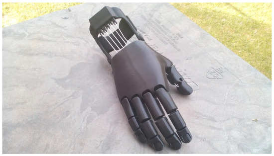 A Perspective on Rehabilitation Through Open-Source Low-Cost 3D-Printed ...