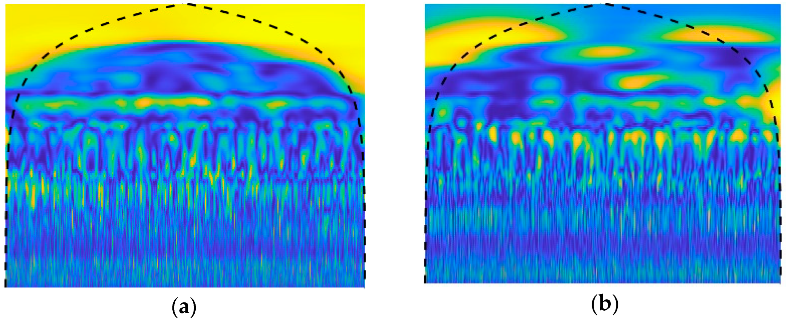 Hybrid Deep Learning Model for Fault Diagnosis in Centrifugal Pumps: A Comparative Study of ...